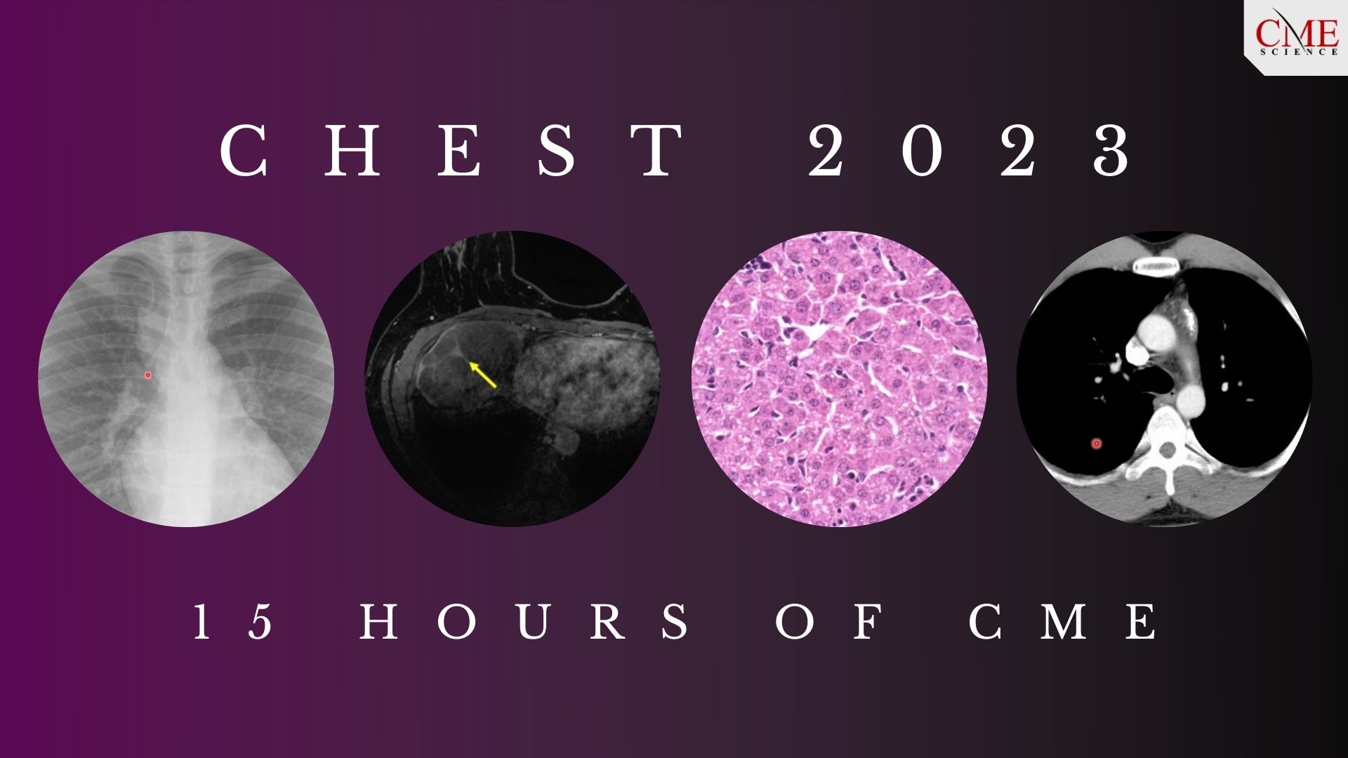 Chest Imaging 2023